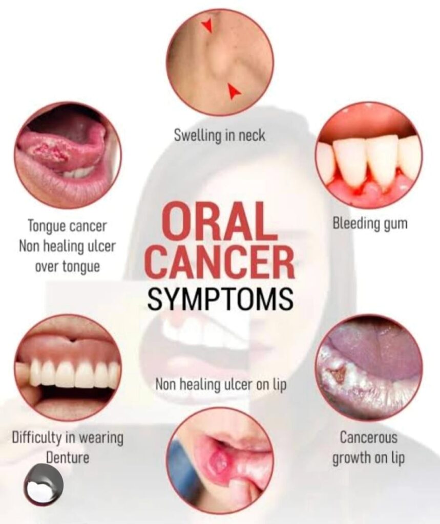 Understanding Oral Cancer: Causes, Symptoms, and Treatment | Surjit ...